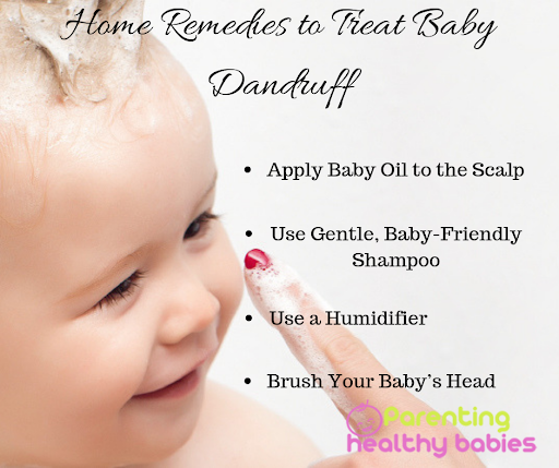 Dandruff in Babies: Causes, Symptoms and Home Remedies